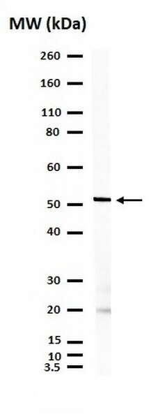 Anti-Cone Arrestin Antibody | AB15282